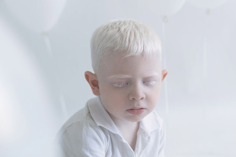She Took Photos Of Albino People In All-White Settings. The Result Is ...