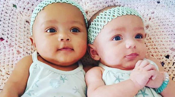 These 'Miracle' Twin Baby Girls Were Born With Different Skin Colors